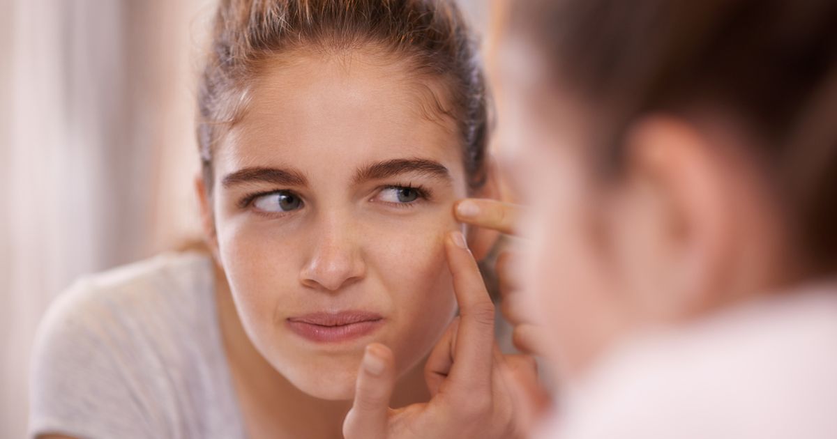 Pickel, Pusteln, Akne: Hautprobleme haben meistens diese eine Ursache ...