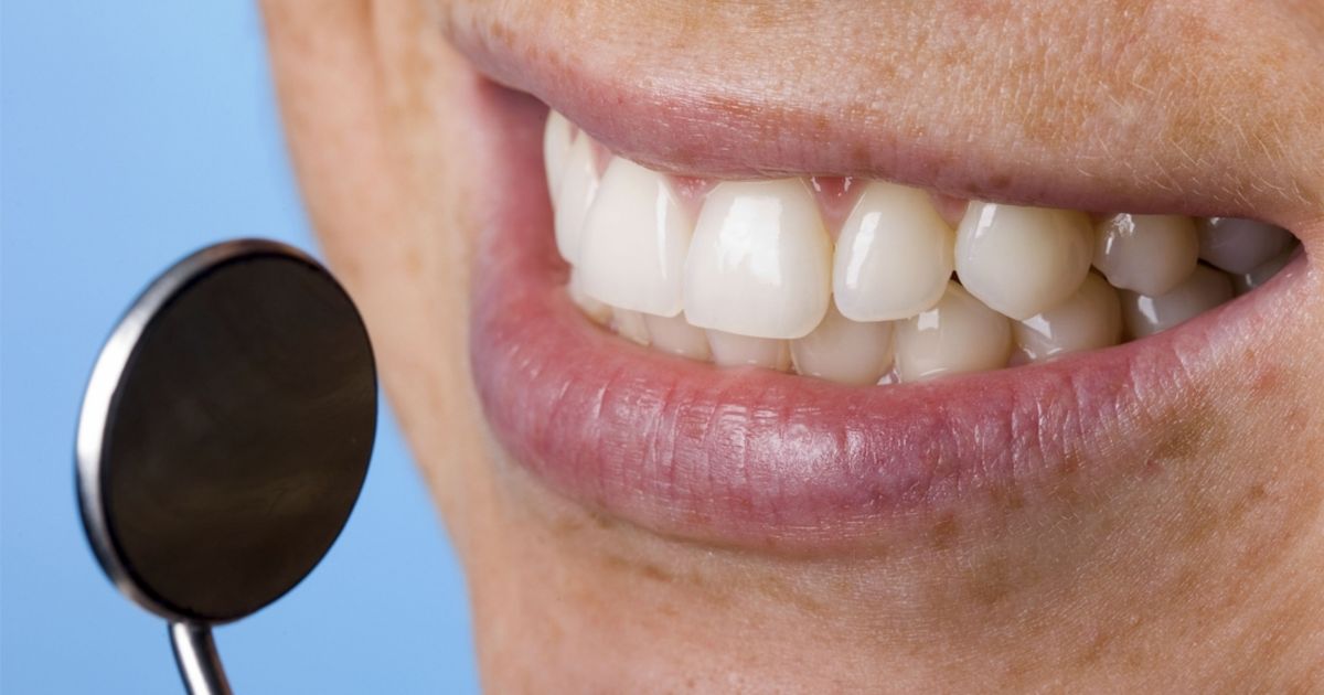 Zahnfleisch: Therapien bei Parodontose | BUNTE.de