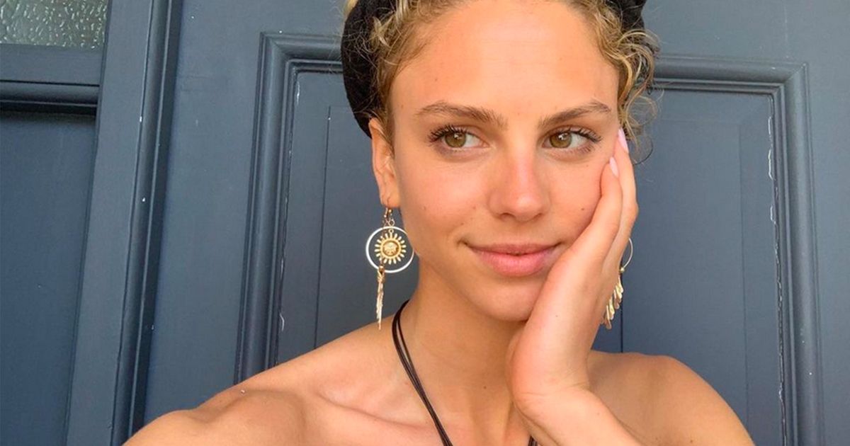GNTM-Model Simone Kowalski: "Ich werde wieder gesund" | BUNTE.de