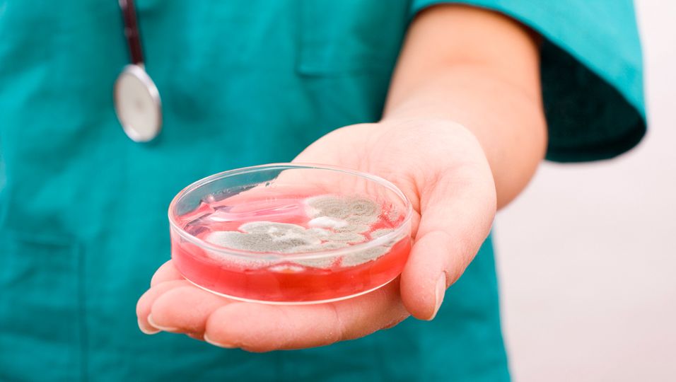 News: 1,5 Millionen Tote durch Pilzinfektionen | BUNTE.de