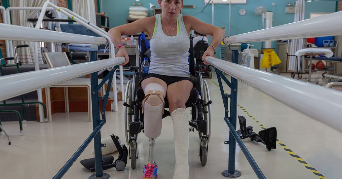 Pure Mutterliebe: Frau lässt sich freiwillig Bein amputieren – um ...