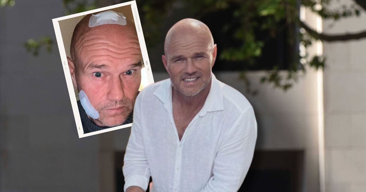 "Goodbye Deutschland"-Star Michael Busse leidet an Hautkrebs | BUNTE.de