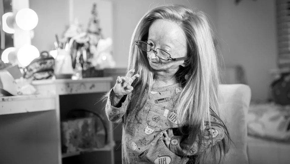 YouTube-Star Adalia Rose Williams: Sie ist mit nur 15 Jahren gestorben ...