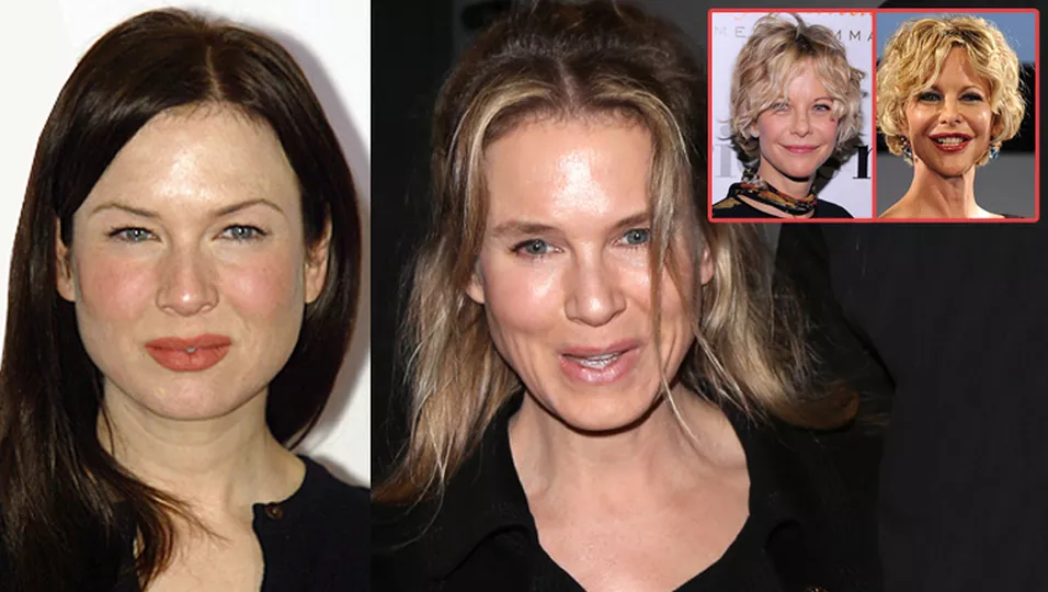 Renée Zellweger: Ist sie die nächste Meg Ryan? | BUNTE.de