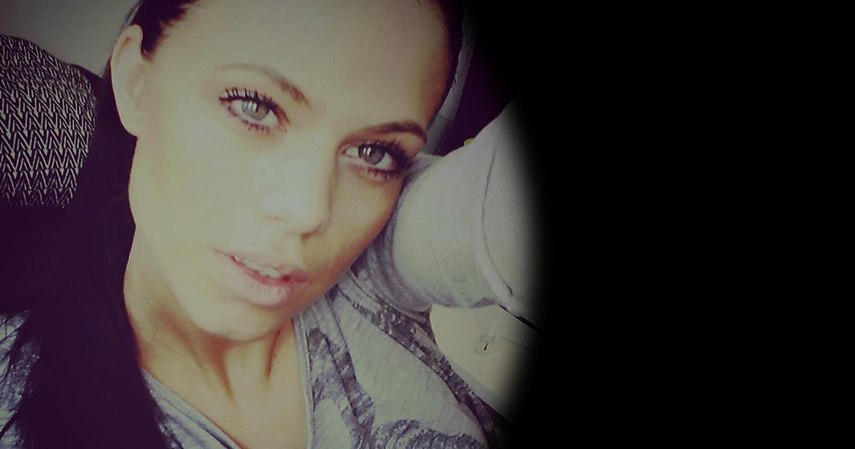 Amajla Omanovic: Topmodel für immer entstellt? | BUNTE.de