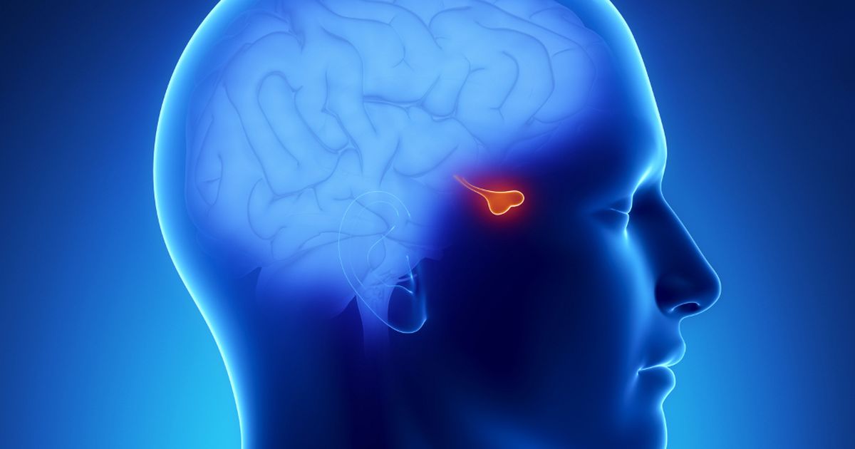 Stoffwechselstörung: Morbus Cushing: Erkrankung der Hypophyse | BUNTE.de